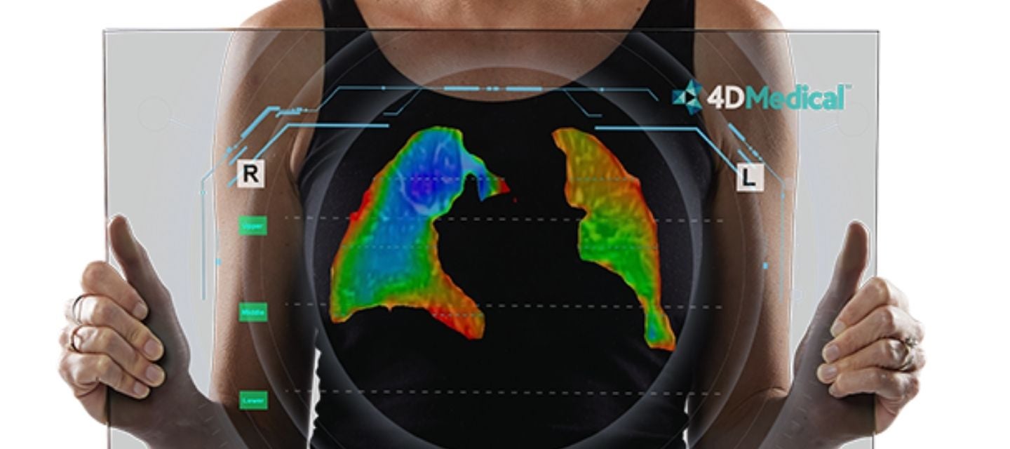 CT Lung Ventilation Analysis Software (CTLVAS) scan. | I-MED Radiology Network